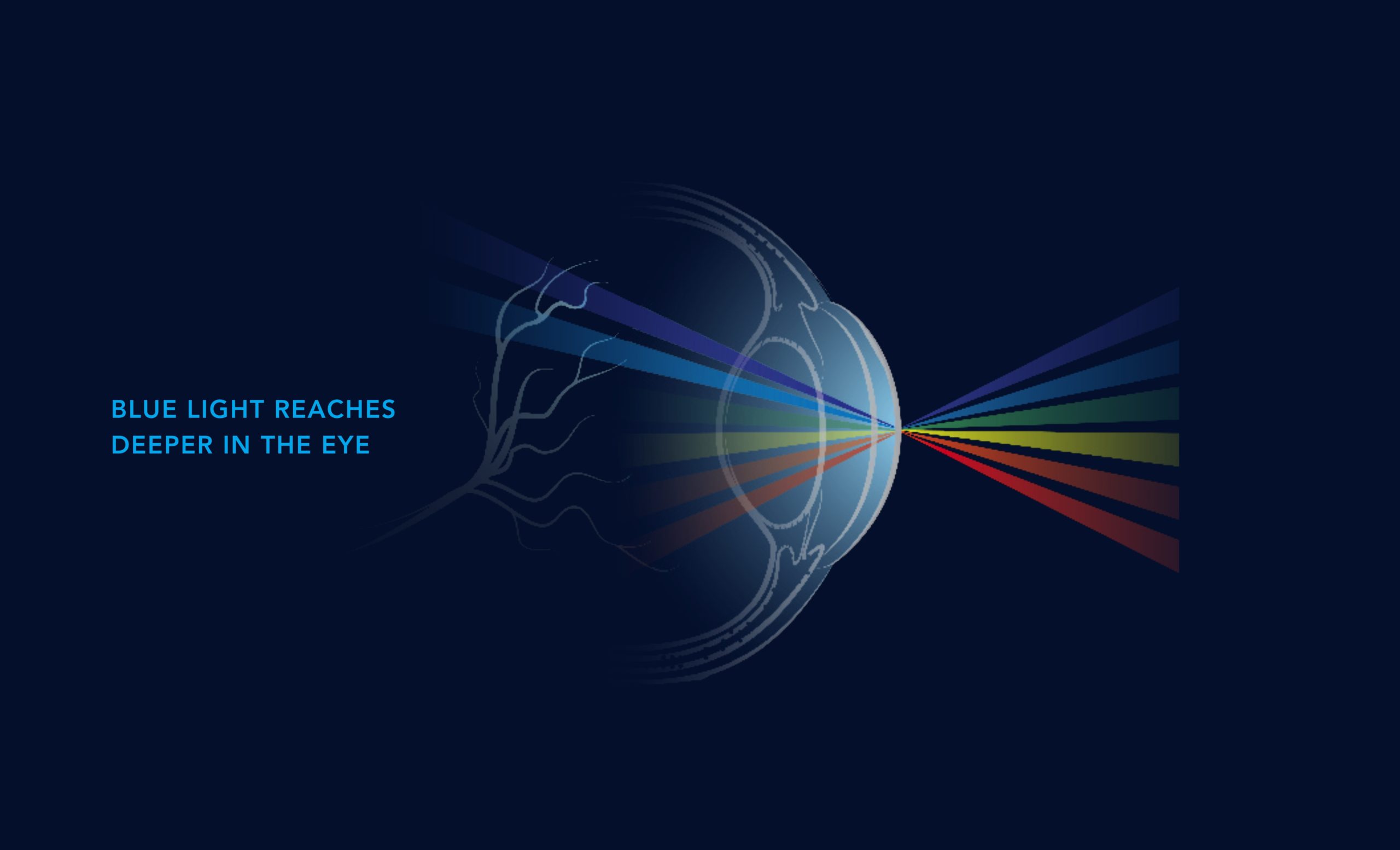 eyeillustrationbluelightreach | Eyesafe