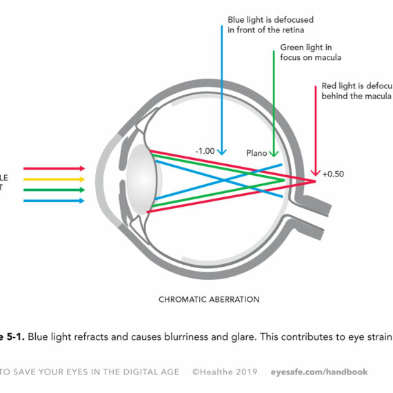 Chapter 5 - Visual Acuity and Dry Eyes | Eyesafe